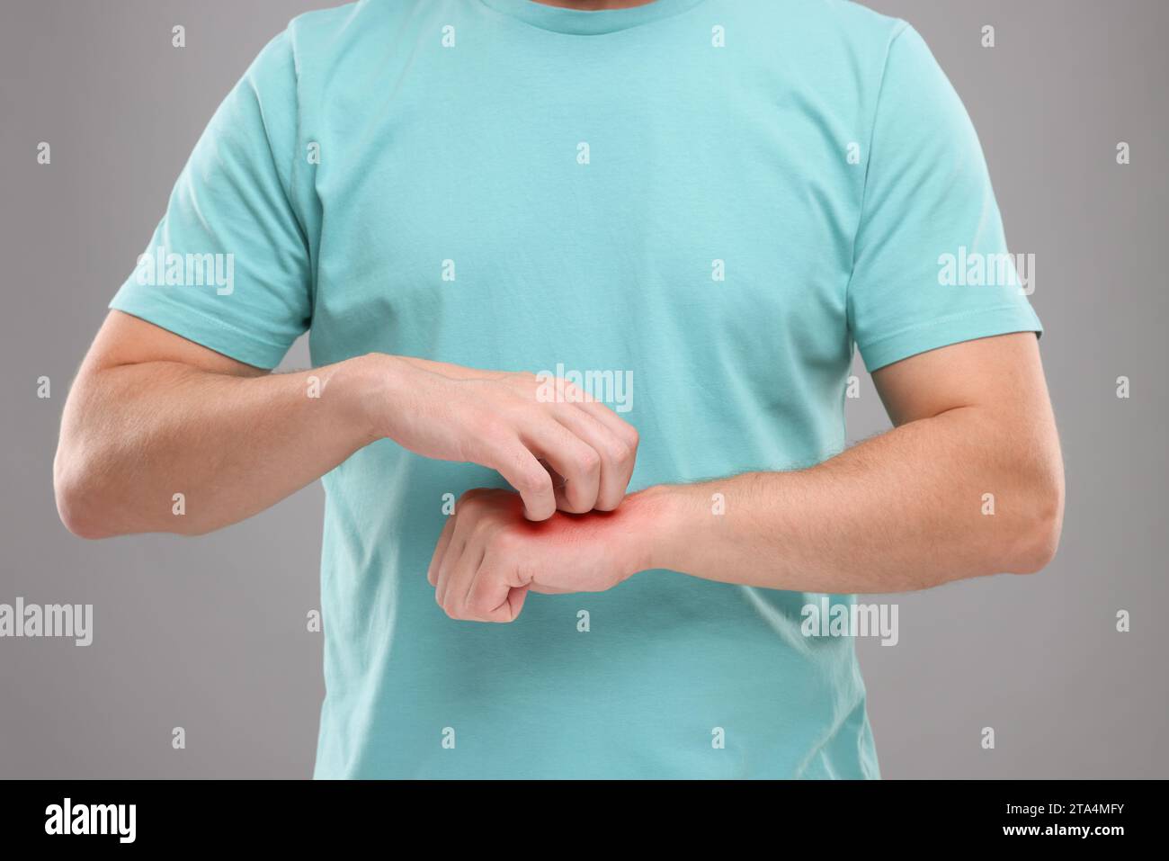 Allergy symptom. Man scratching his hand on light grey background ...
