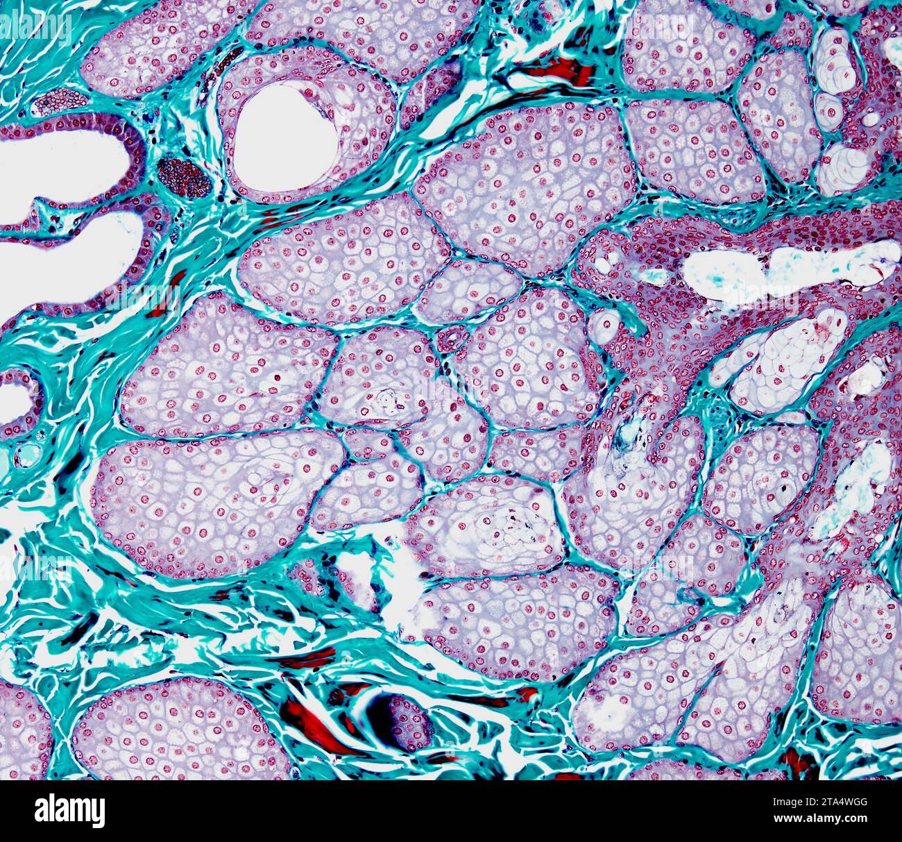 Sebaceous gland, light micrograph Stock Photo - Alamy