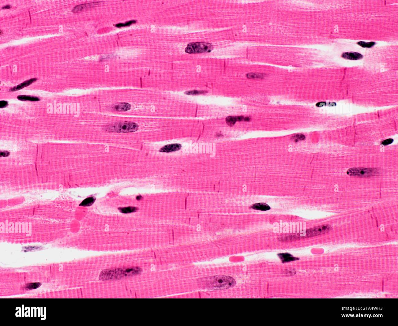 Heart muscle, light micrograph Stock Photo - Alamy
