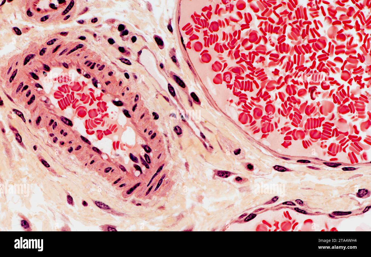 Artery and vein, light micrograph Stock Photo - Alamy