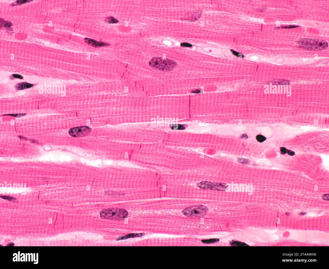 Heart muscle, light micrograph Stock Photo - Alamy