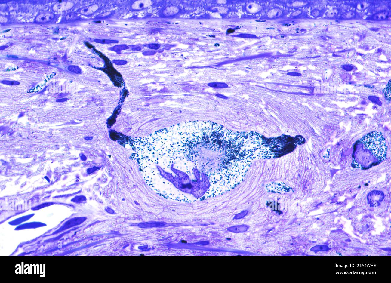 Artery and vein, light micrograph Stock Photo - Alamy