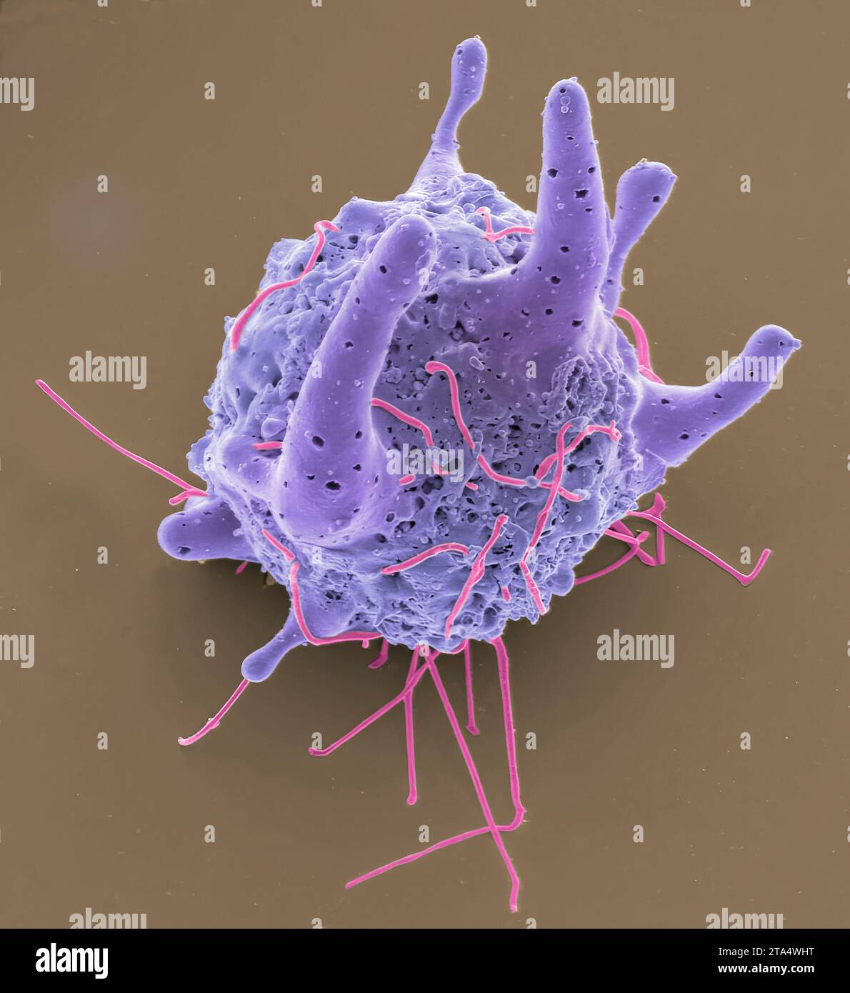 Respiratory Syncytial Virus, SEM Stock Photo - Alamy