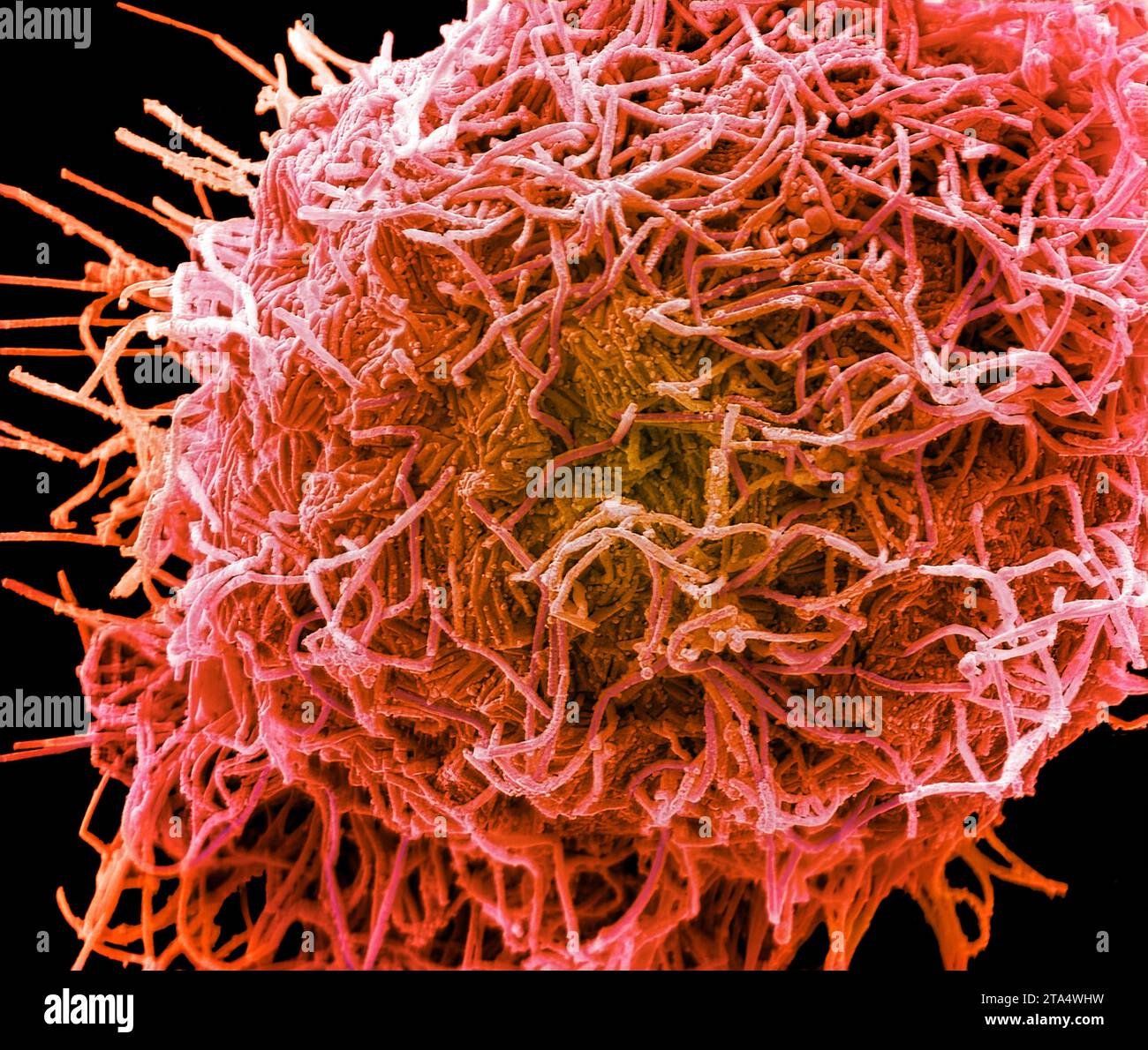 Respiratory Syncytial Virus, SEM Stock Photo - Alamy