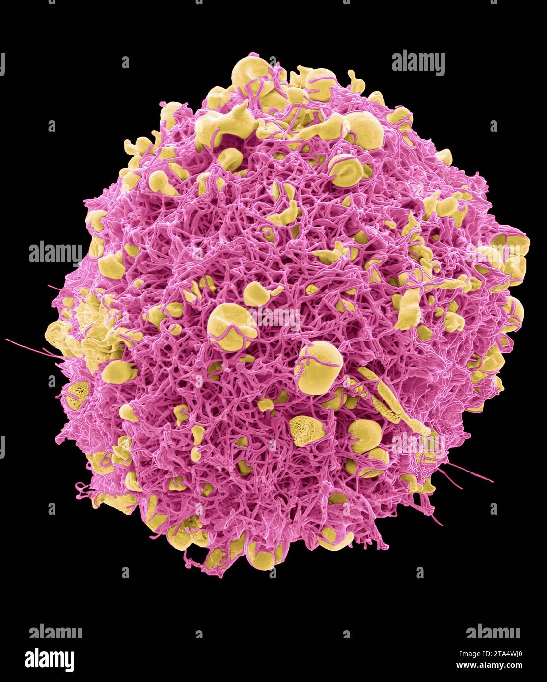 Respiratory Syncytial Virus, SEM Stock Photo - Alamy