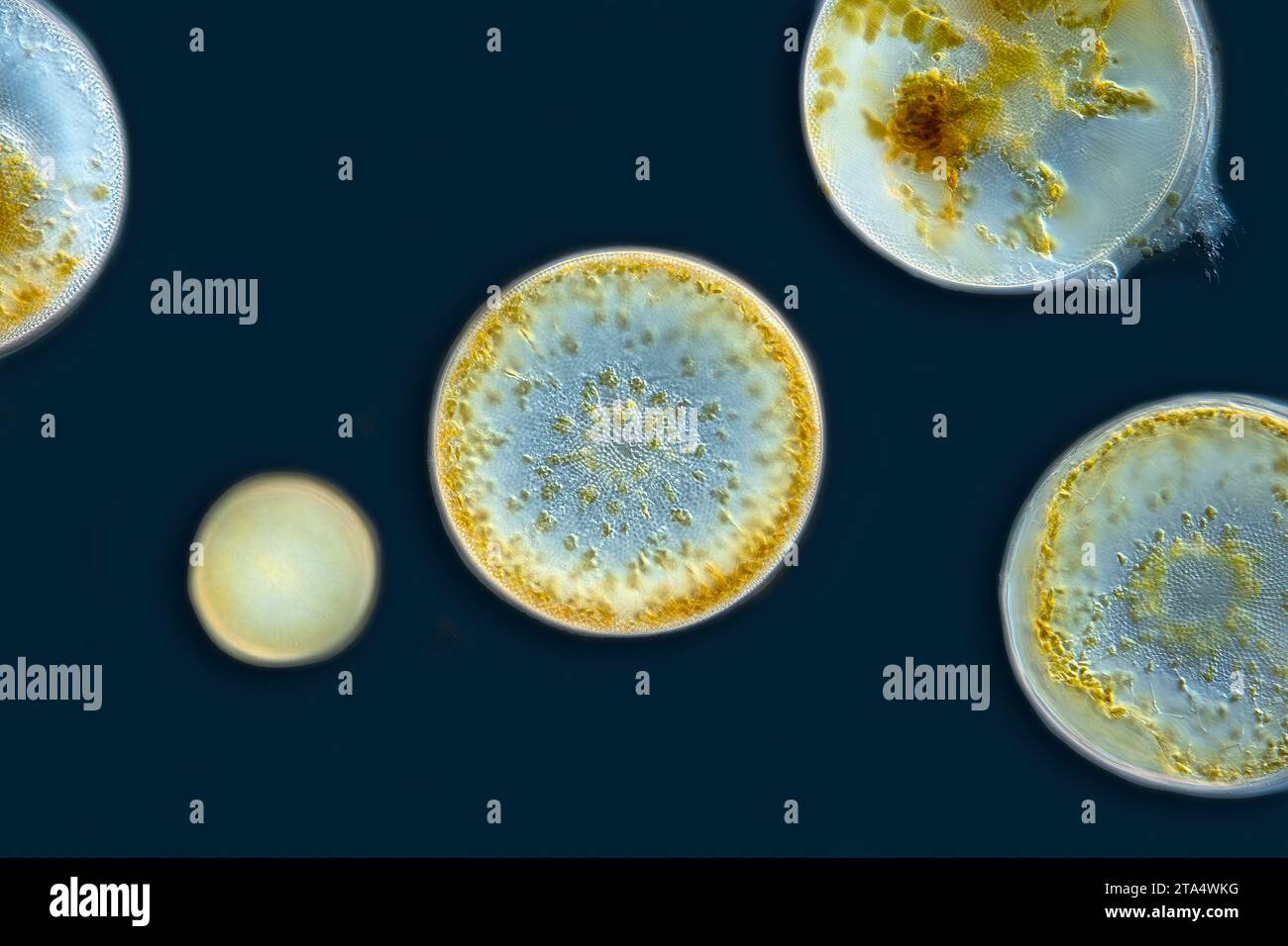 Coscinodiscus algae, light micrograph Stock Photo - Alamy