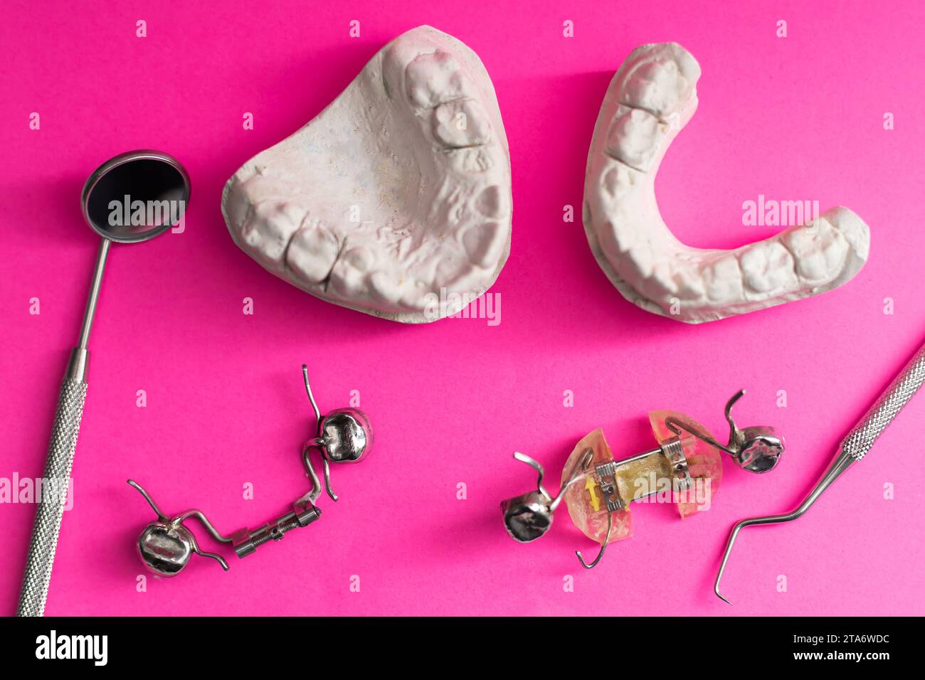 Dental casting gypsum model of human jaws. Crooked teeth and distal ...