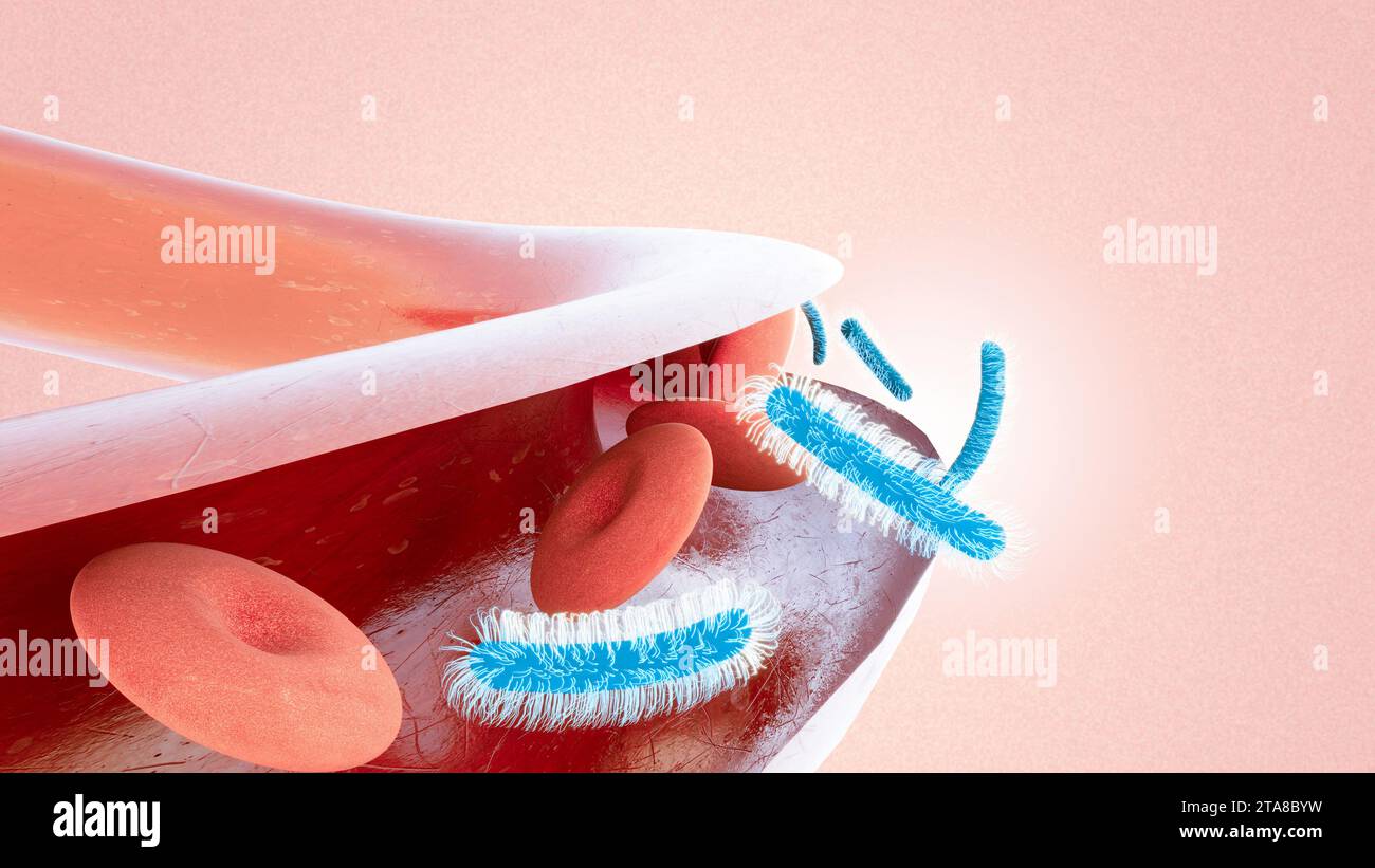 Blood flow, vein and red blood cells and sepsis. It is a potentially ...