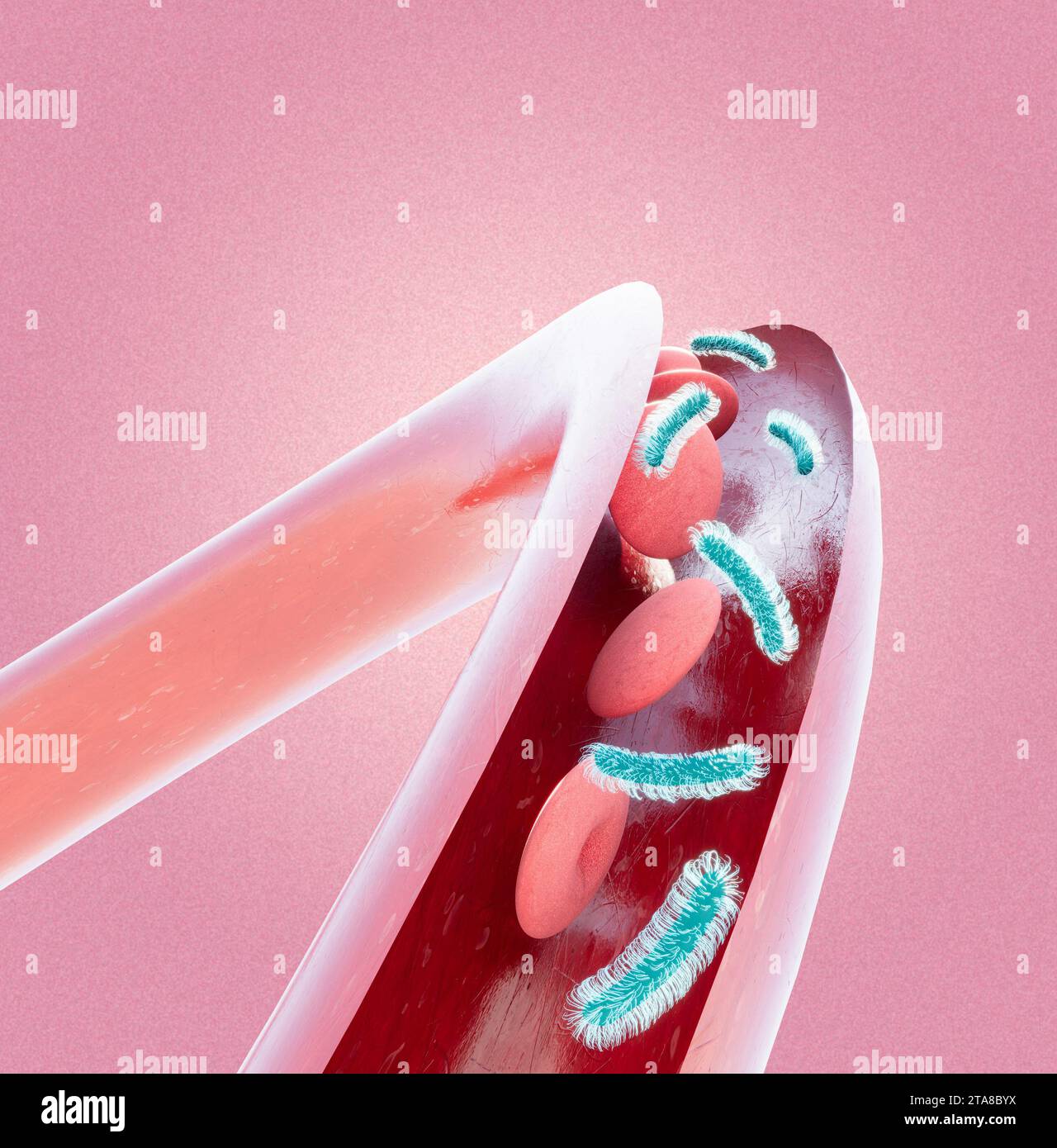 Blood flow, vein and red blood cells and sepsis. It is a potentially ...