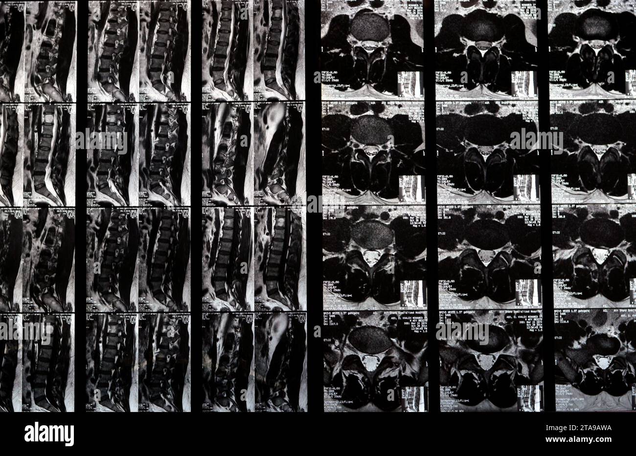 L5 s1 hi-res stock photography and images - Alamy