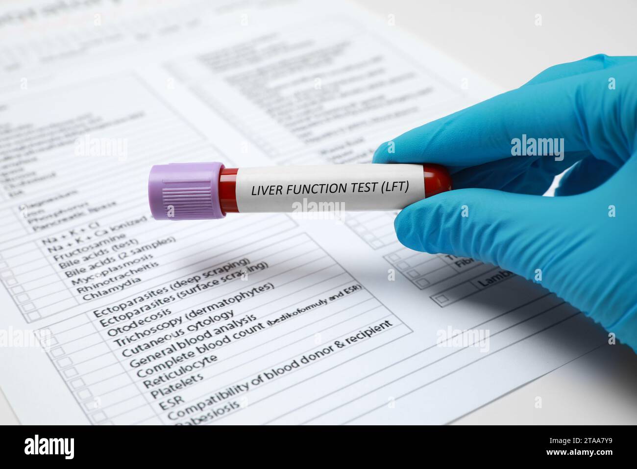Laboratory worker holding tube with blood sample and label Liver ...