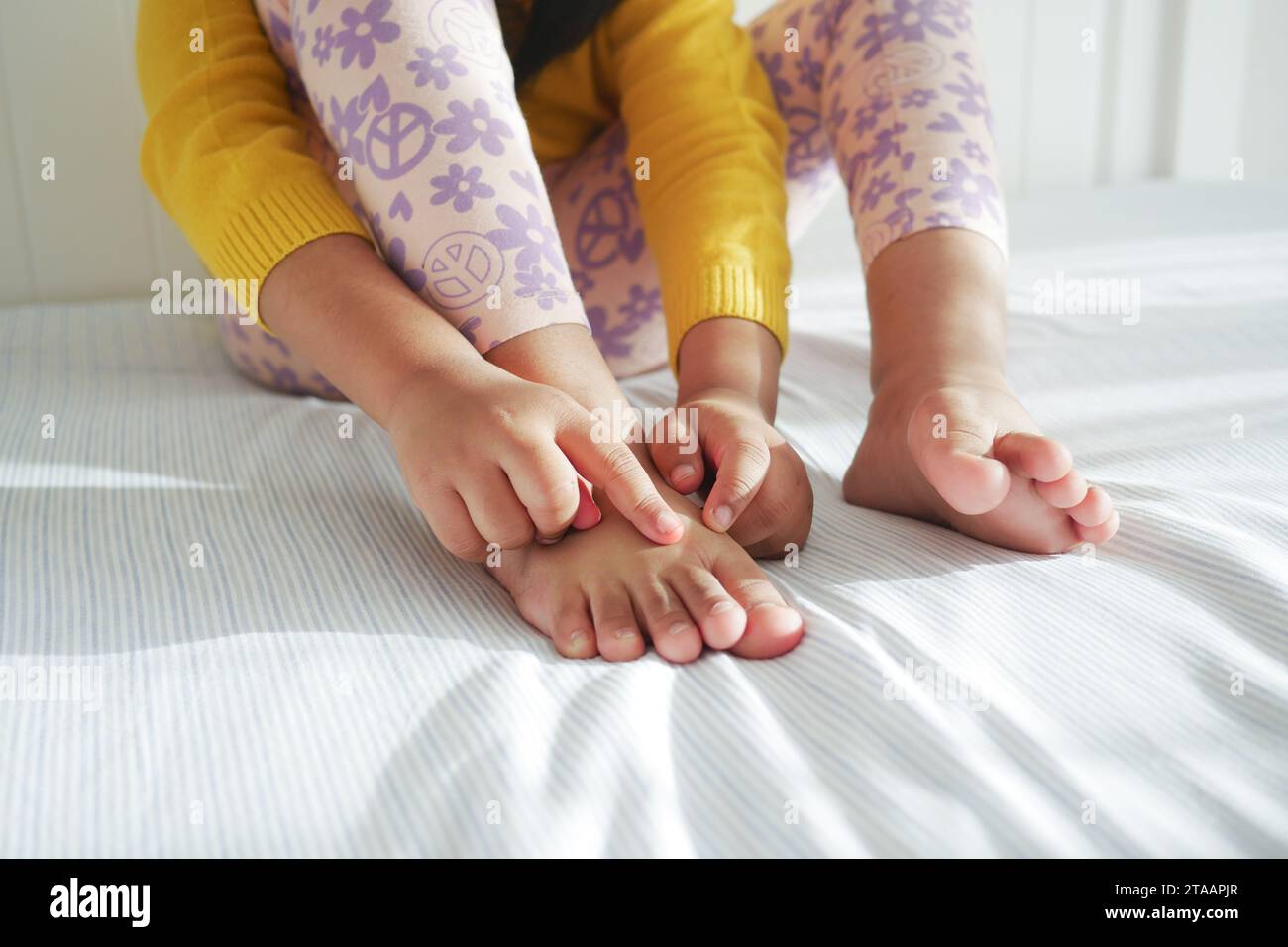 child girl suffering from itching skin on hand Stock Photo - Alamy