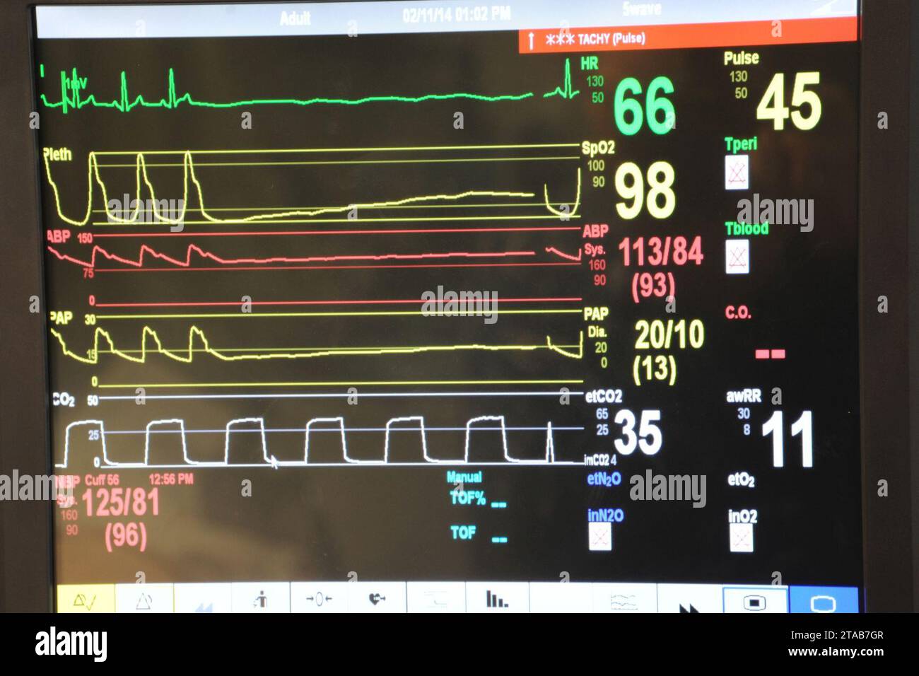 Vital signs monitor display Stock Photo - Alamy
