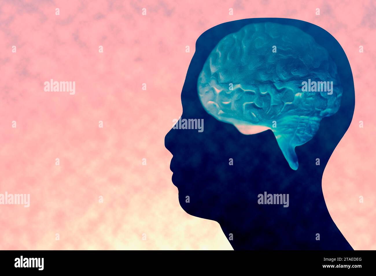 Medical acupuncture model of human with brain anatomical model Stock ...