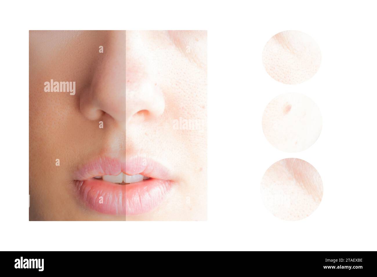 Skin retouching Cut Out Stock Images & Pictures - Alamy