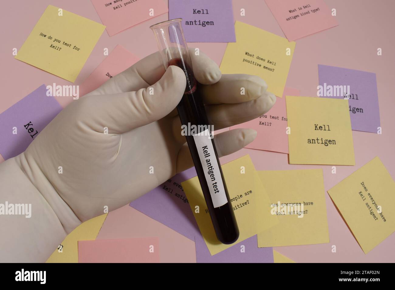 Kell antigen concept. Notes with questions about Kell antigen and 4 ...