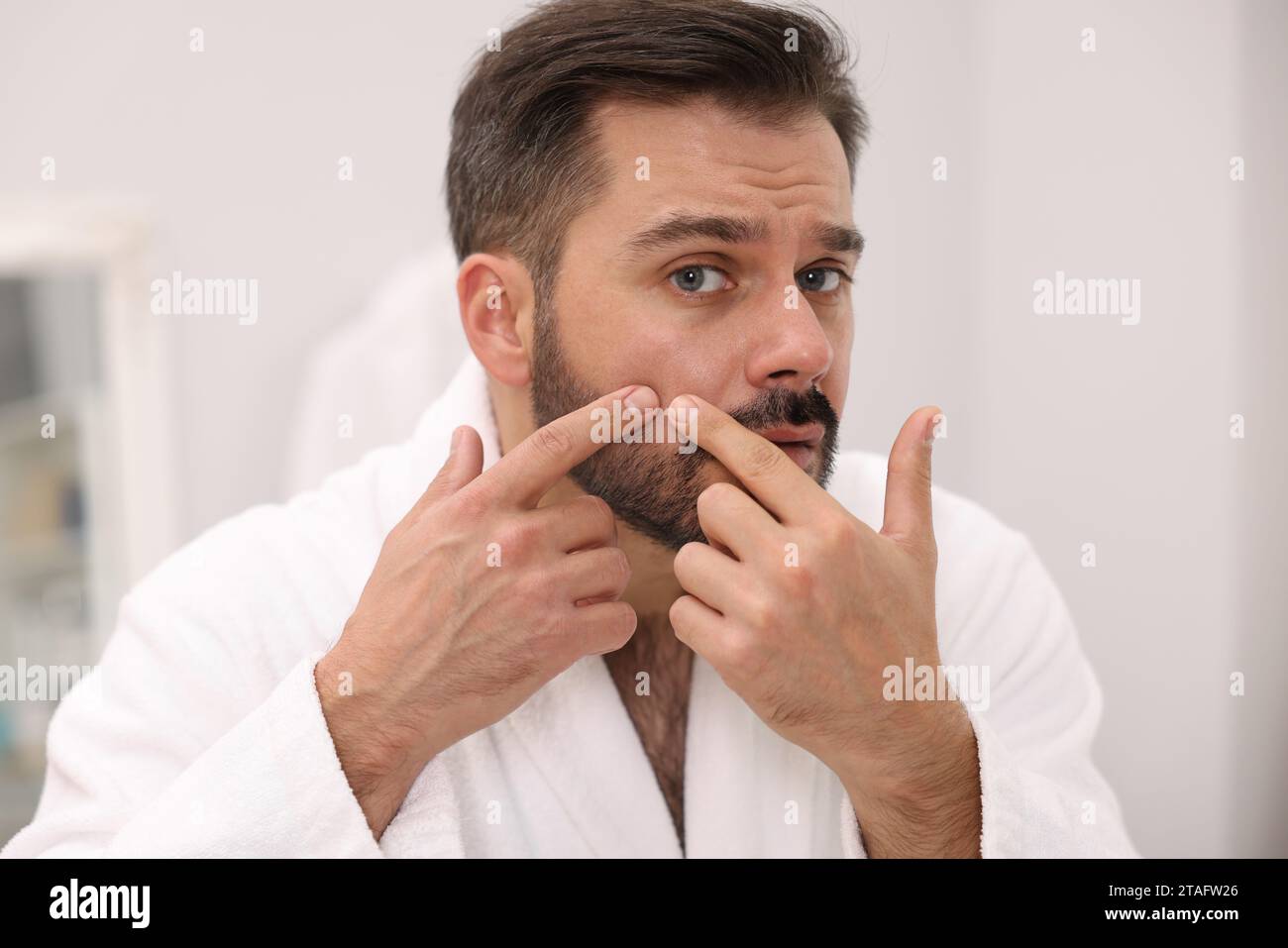 Skin problem. Man touching his face indoors Stock Photo - Alamy