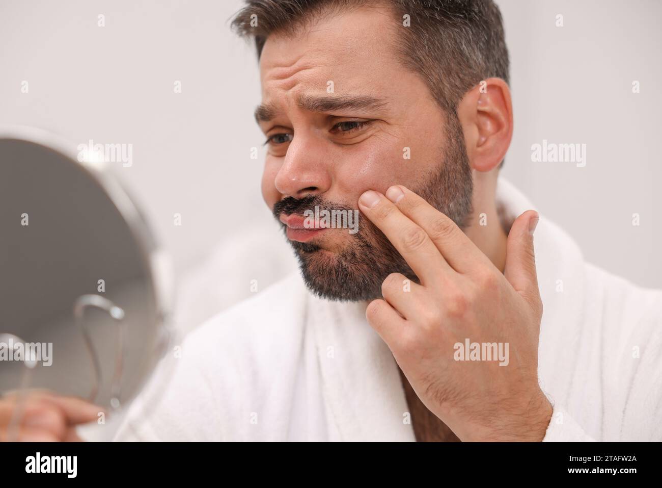 Confused man with skin problem looking at mirror indoors Stock Photo ...