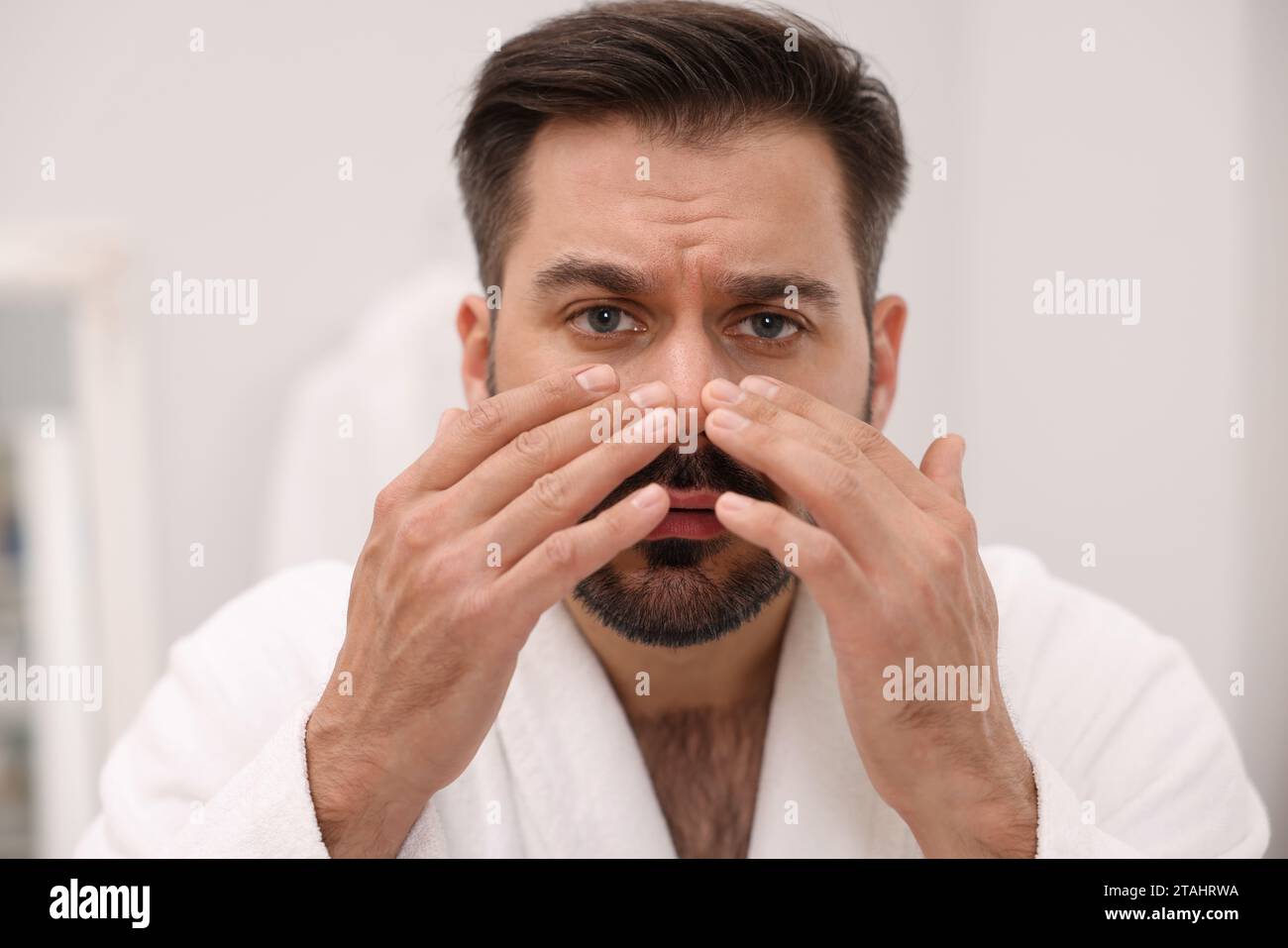 Skin problem. Confused man touching his face indoors Stock Photo - Alamy