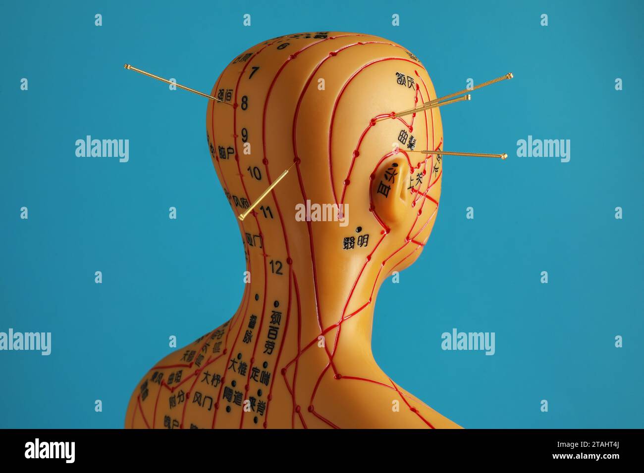 Acupuncture - alternative medicine. Human model with needles in head ...