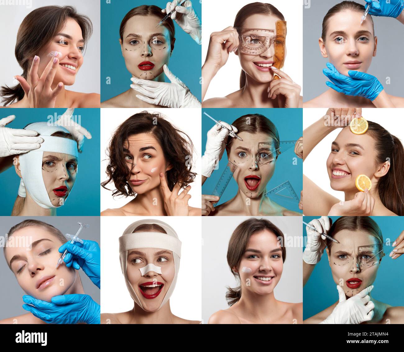 Collage. Beautiful young women with healthy faces doing antiaging and thread lifting against ...