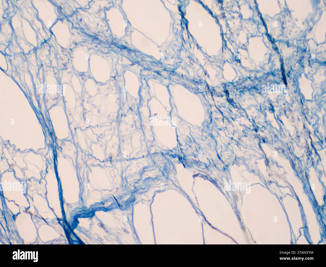 Connective tissue matrix hi-res stock photography and images - Alamy