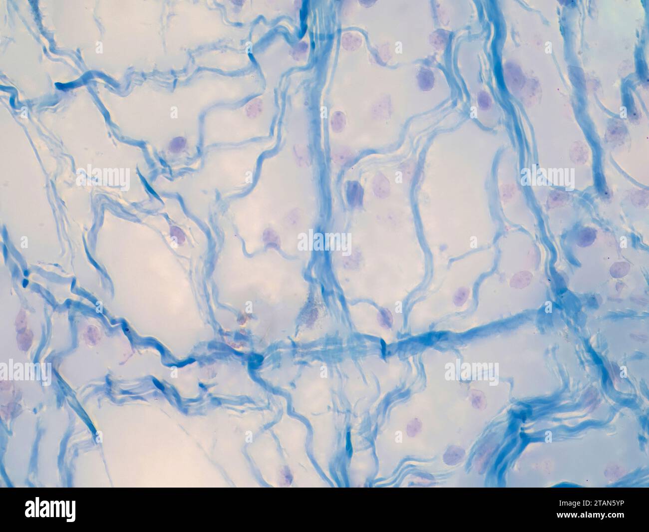 Connective tissue matrix hi-res stock photography and images - Alamy