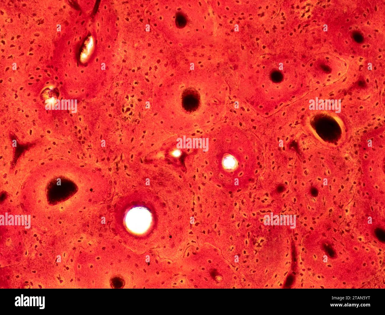 Human compact bone tissue, light micrograph Stock Photo - Alamy