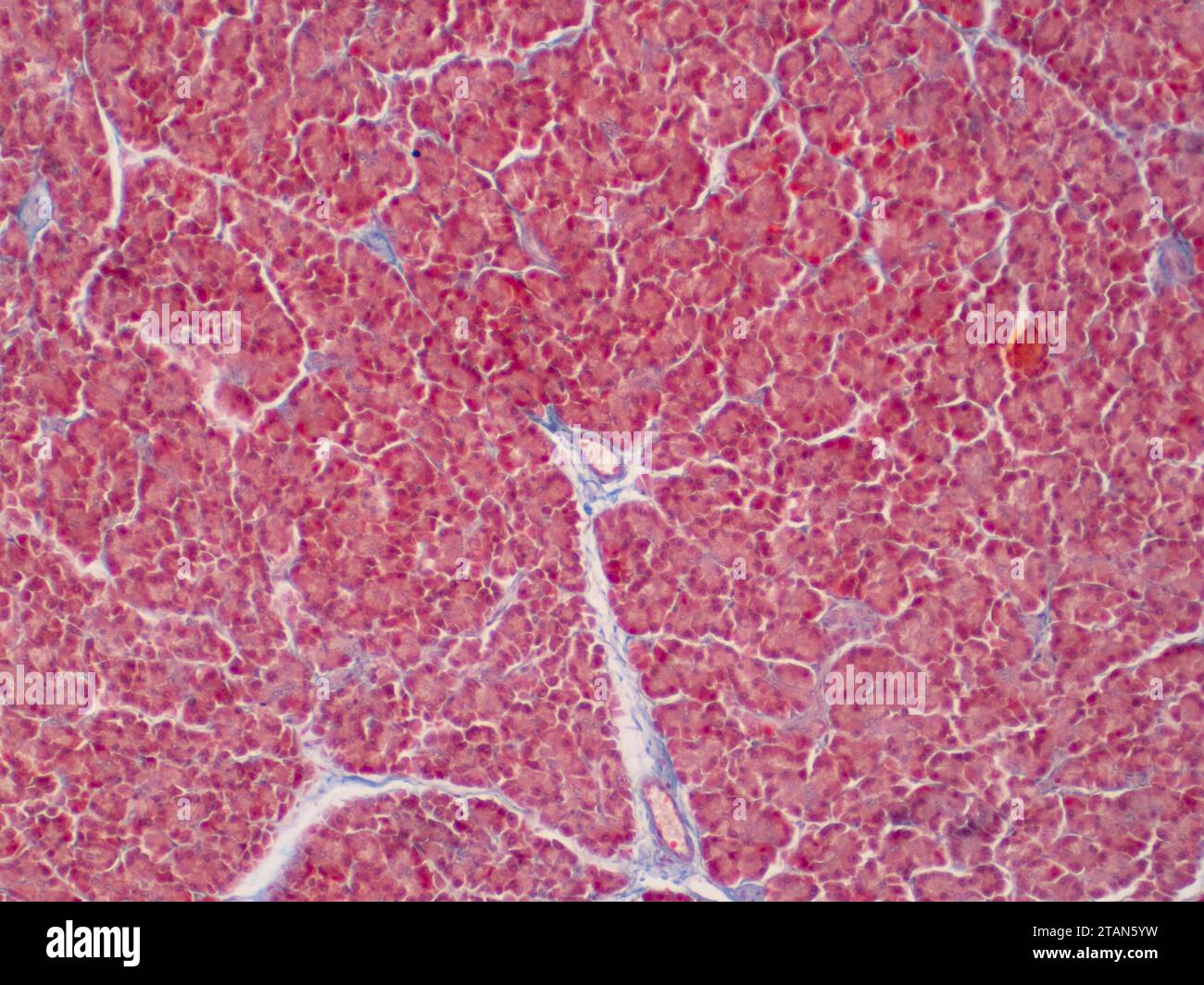 Human liver tissue, light micrograph Stock Photo - Alamy