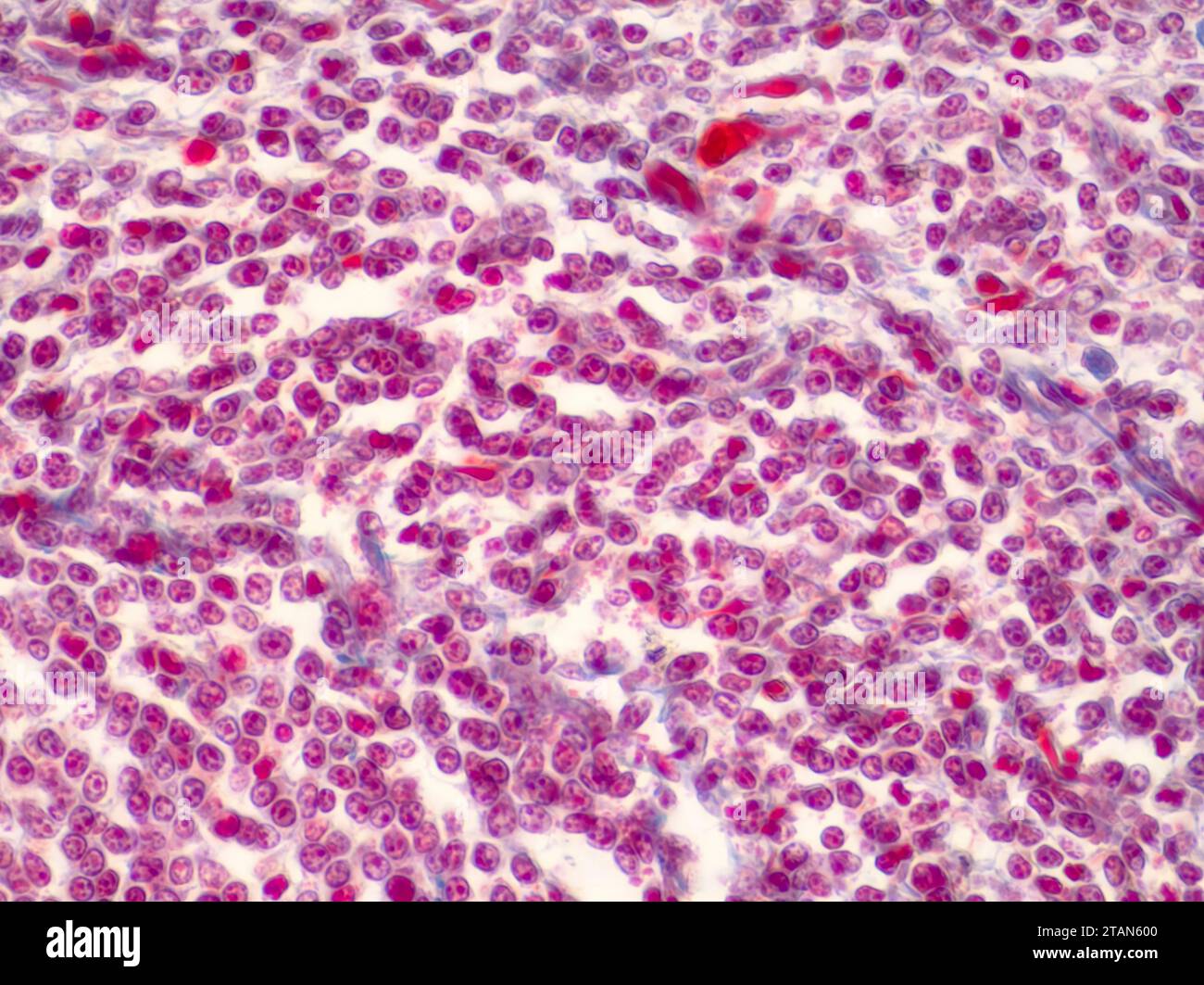 Human liver tissue, light micrograph Stock Photo - Alamy