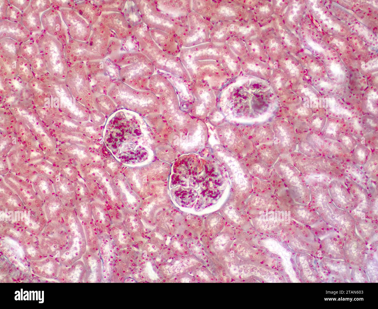 Human kidney, light micrograph Stock Photo - Alamy
