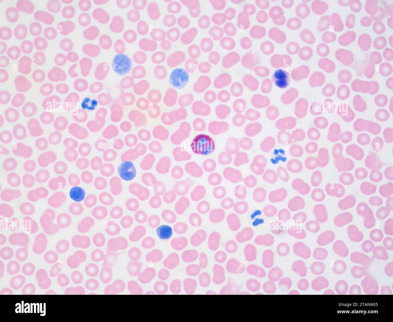 Blood cells, light micrograph Stock Photo - Alamy