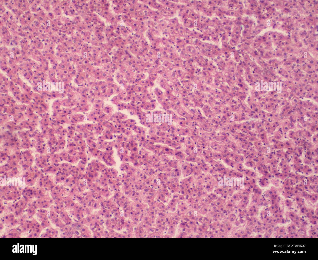 Human anatomy of the liver hi-res stock photography and images - Alamy