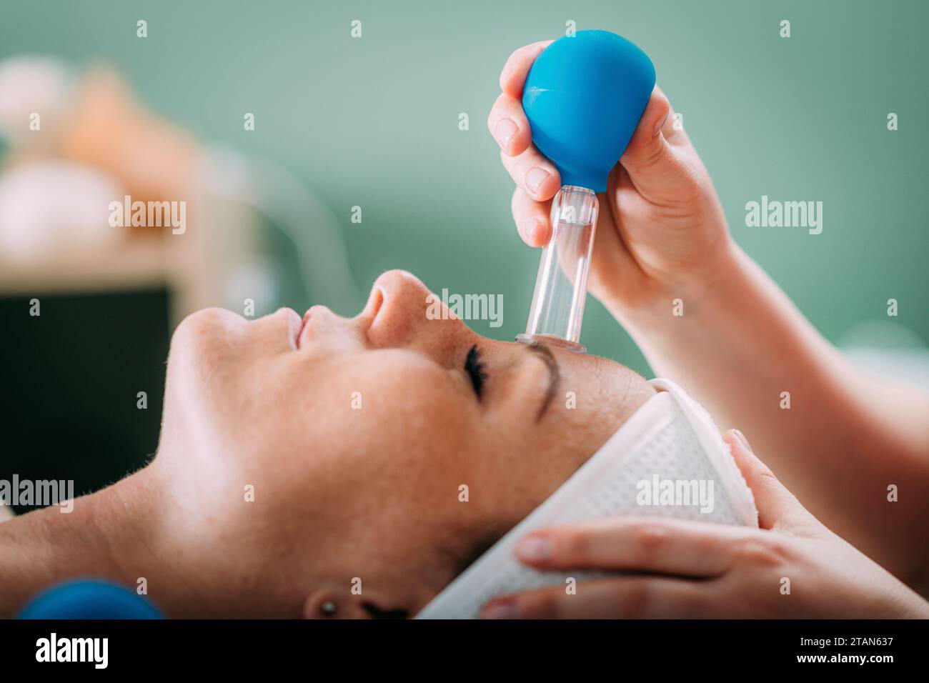Face cupping therapy Stock Photo - Alamy