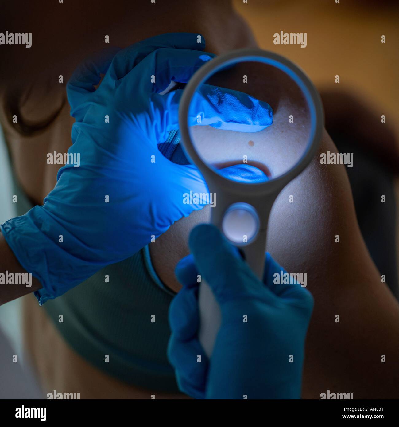 Skin cancer checking hi-res stock photography and images - Alamy