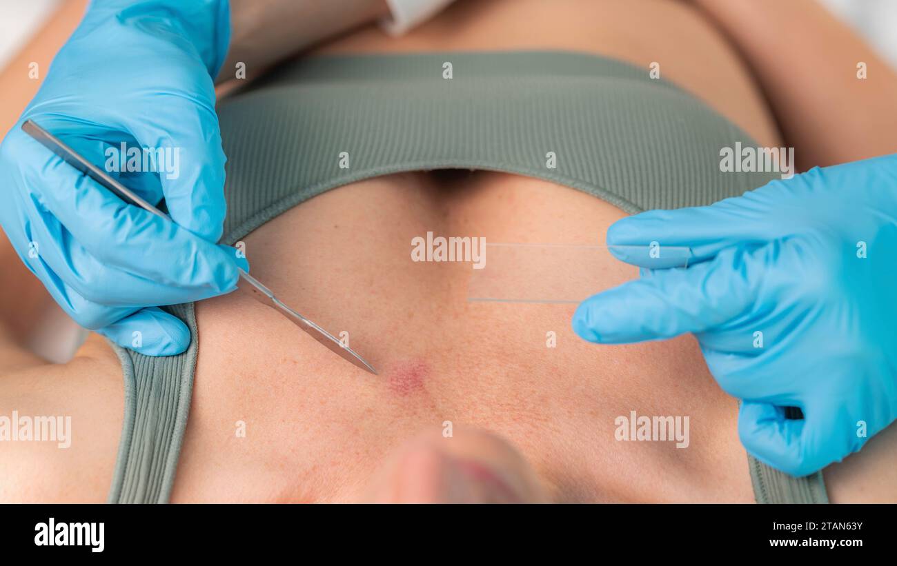 Dermatological practices hi-res stock photography and images - Alamy