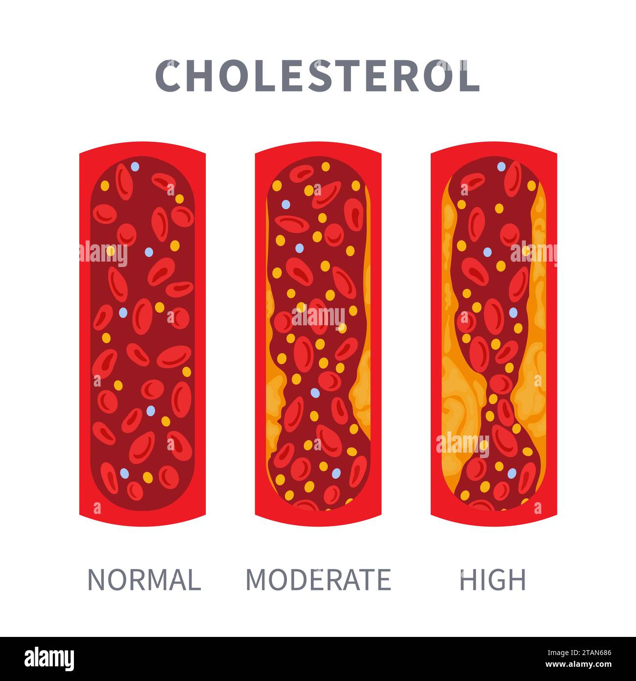 Cholesterol levels, conceptual illustration Stock Photo - Alamy
