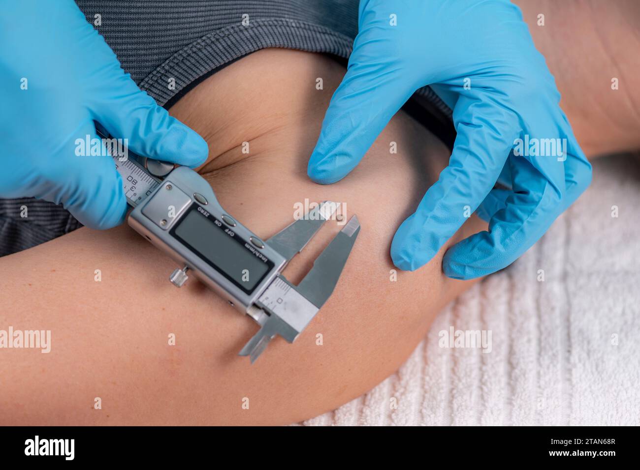 Mole evaluation hi-res stock photography and images - Alamy