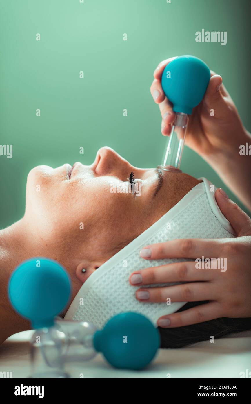 Face cupping therapy Stock Photo - Alamy