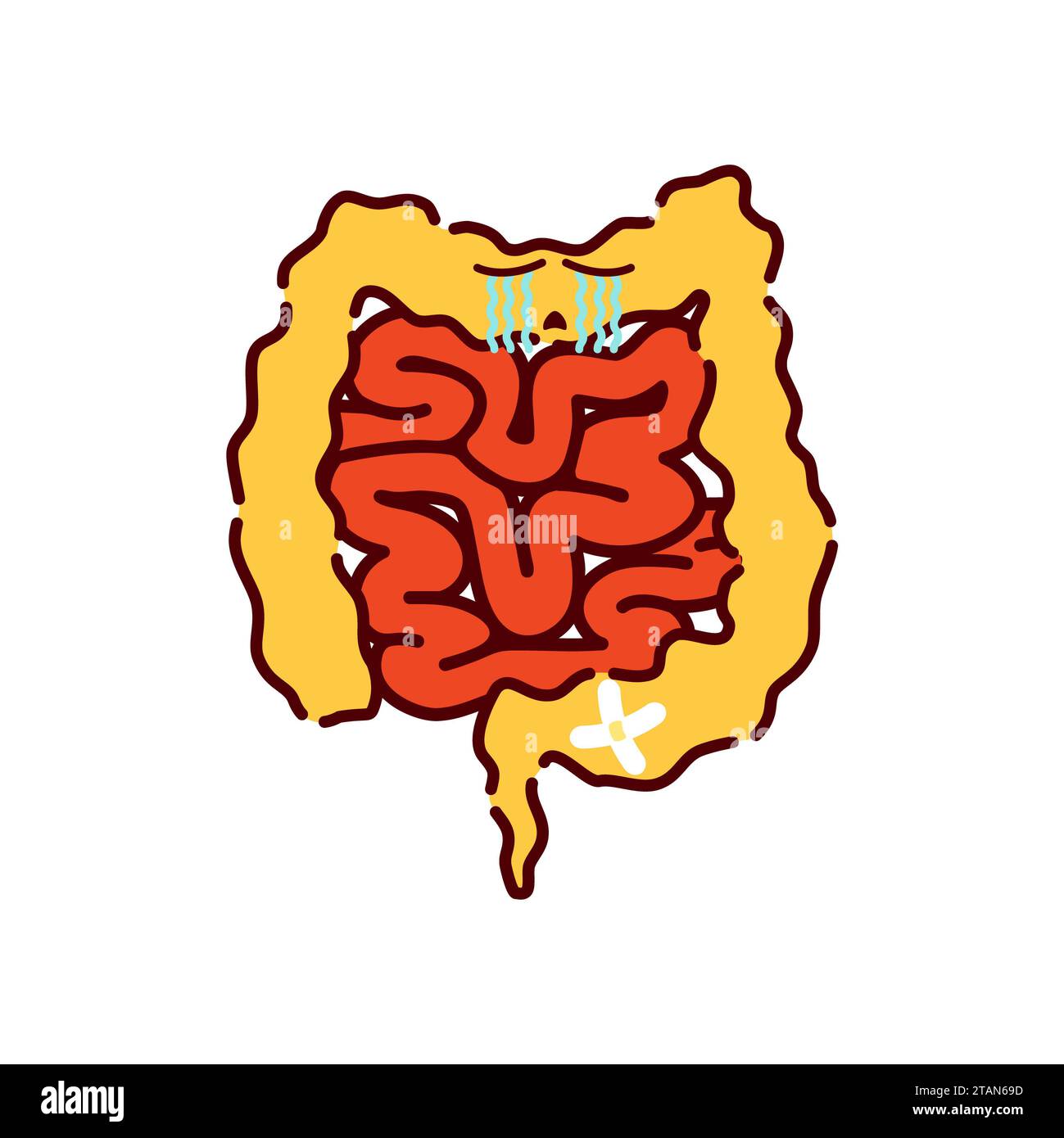 Ulcerative colitis hi-res stock photography and images - Alamy