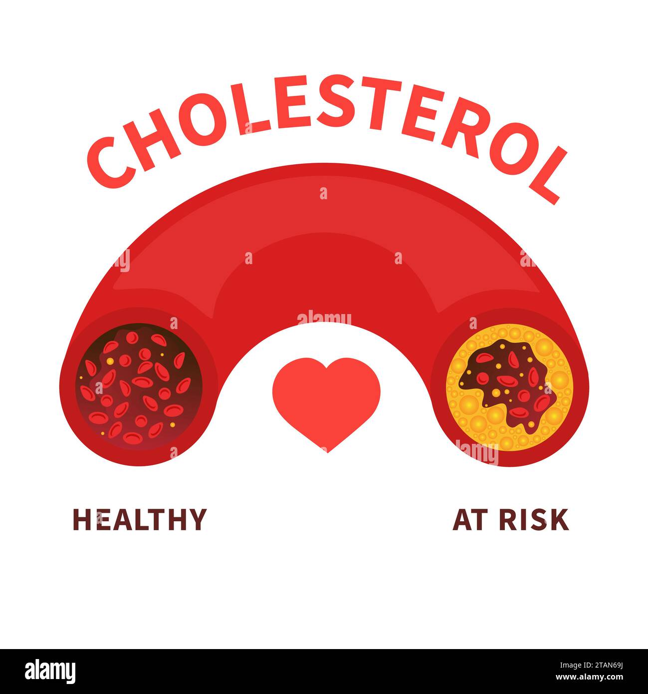 Cholesterol levels, conceptual illustration Stock Photo - Alamy