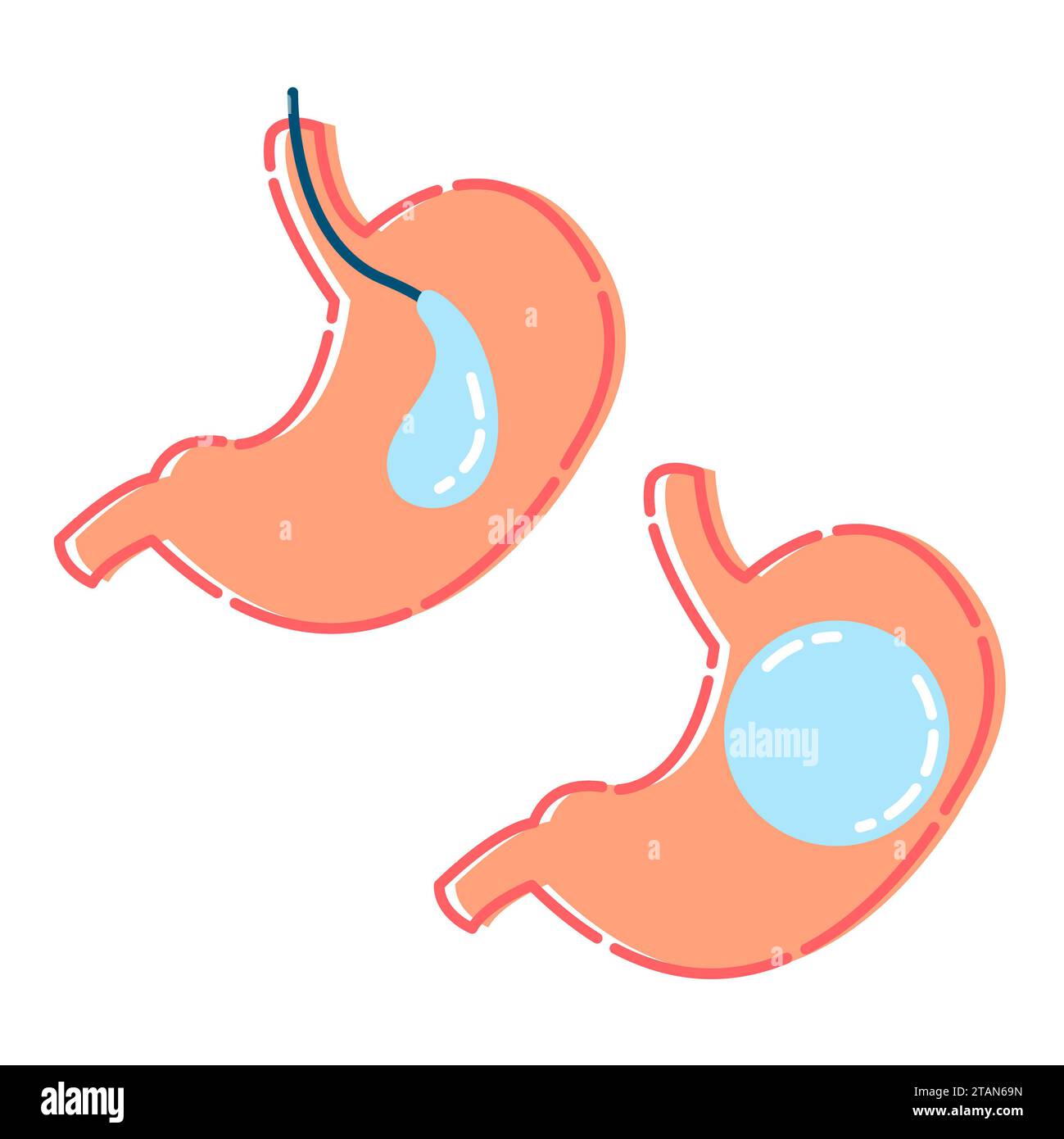 Fat balloon hi-res stock photography and images - Alamy