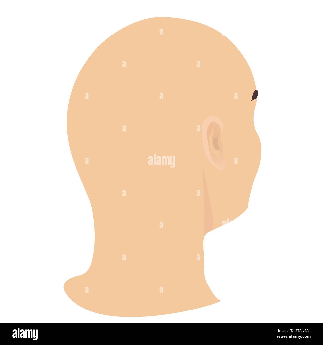 Alopecia in men, conceptual illustration Stock Photo - Alamy Alopecia in men, conceptual illustration Stock Photo - Alamy