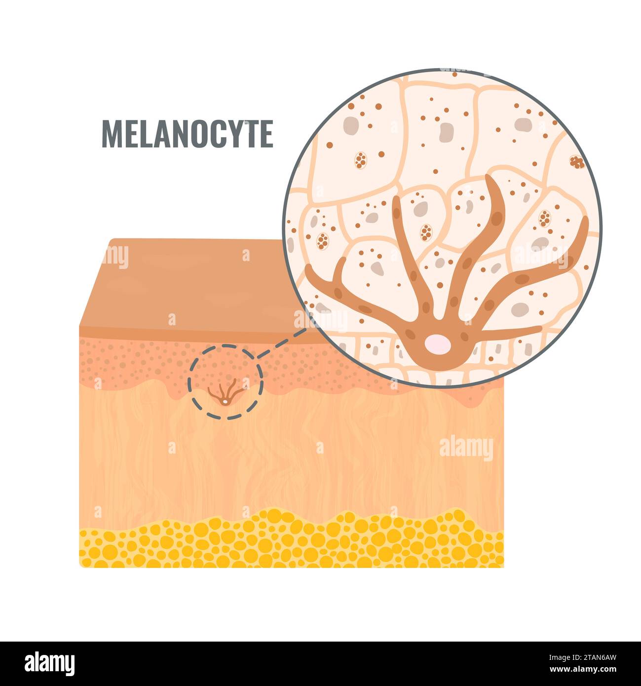 Skin pigmentation, conceptual illustration Stock Photo - Alamy