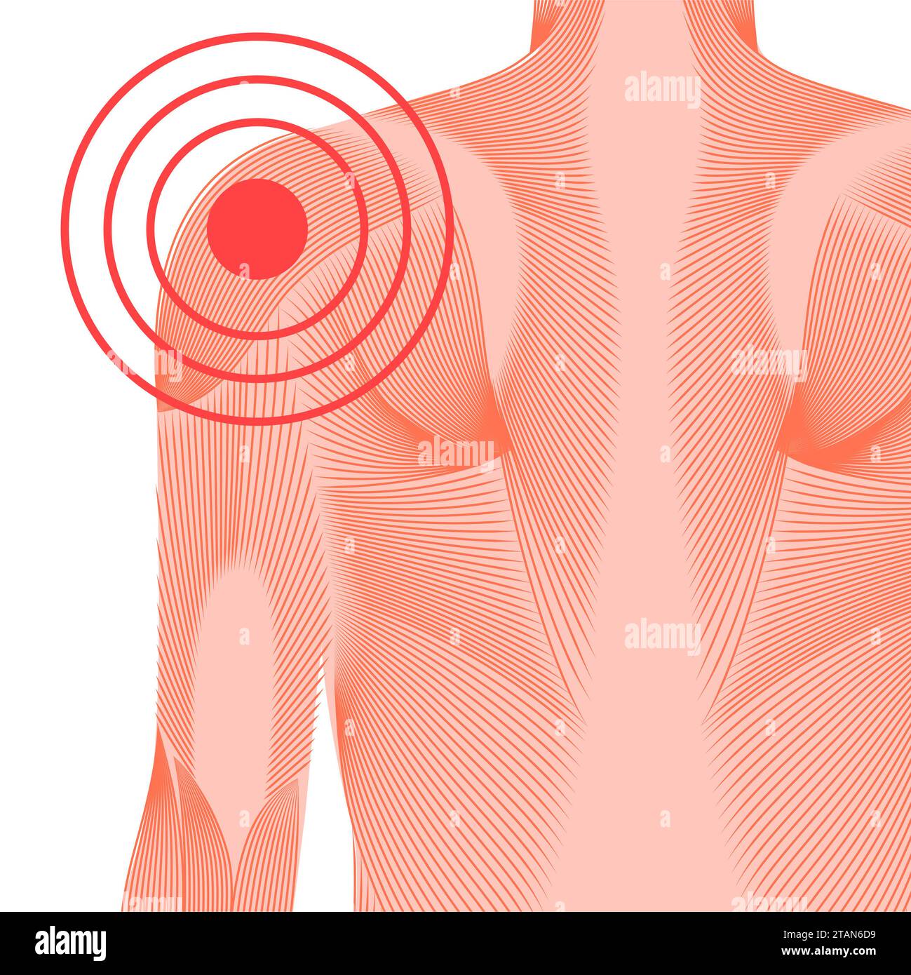 Shoulder pain, conceptual illustration Stock Photo - Alamy