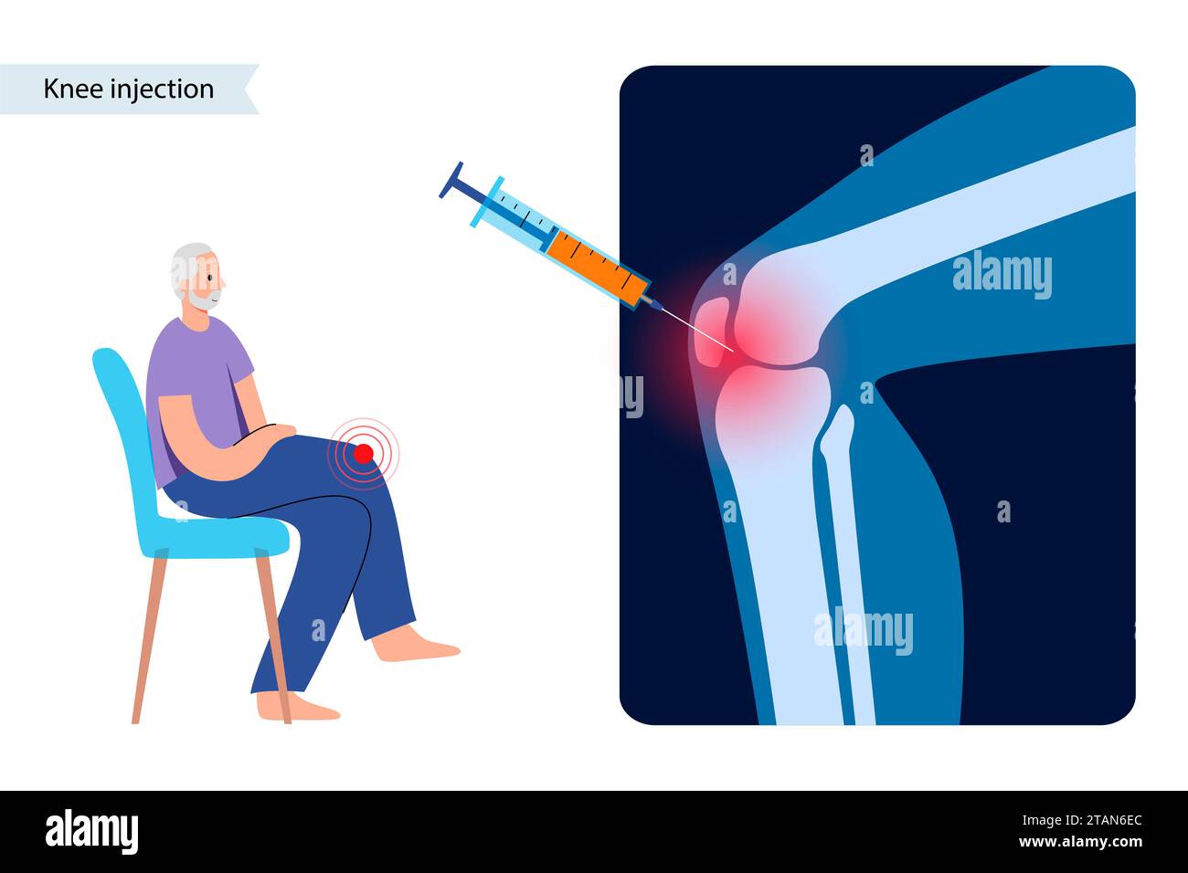 Injection for knee pain, illustration Stock Photo - Alamy