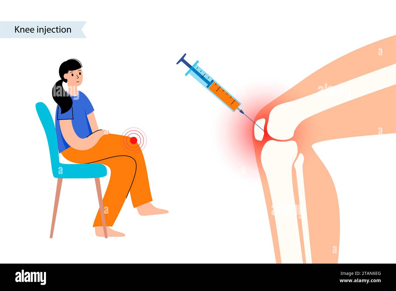 Injection for knee pain, illustration Stock Photo - Alamy