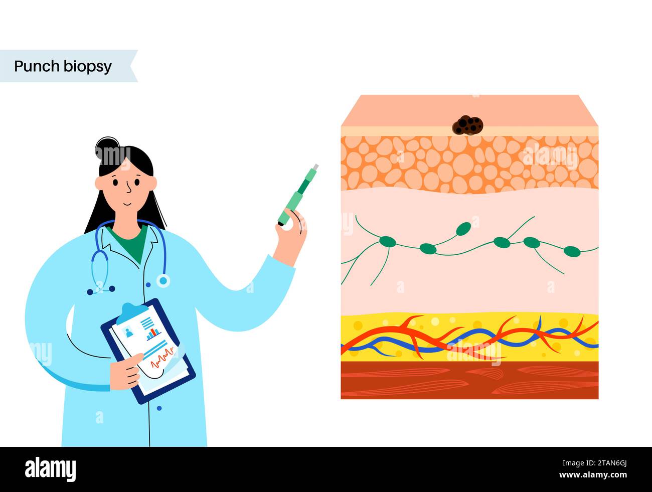 Skin biopsy hi-res stock photography and images - Alamy