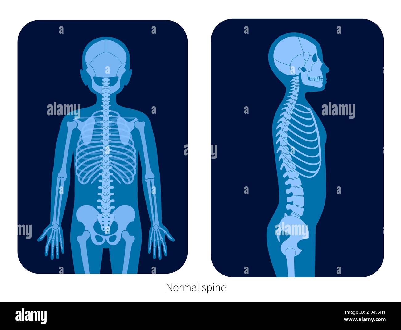 Healthy spine, illustration Stock Photo - Alamy