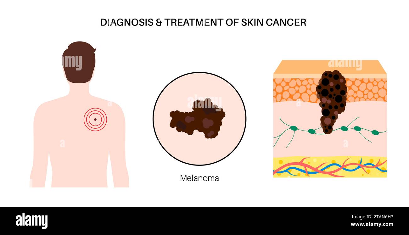 Skin type treatment Cut Out Stock Images & Pictures - Alamy